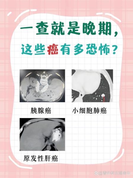 癌症是骗局吗_癌症治疗真相-第2张图片-山城妙识