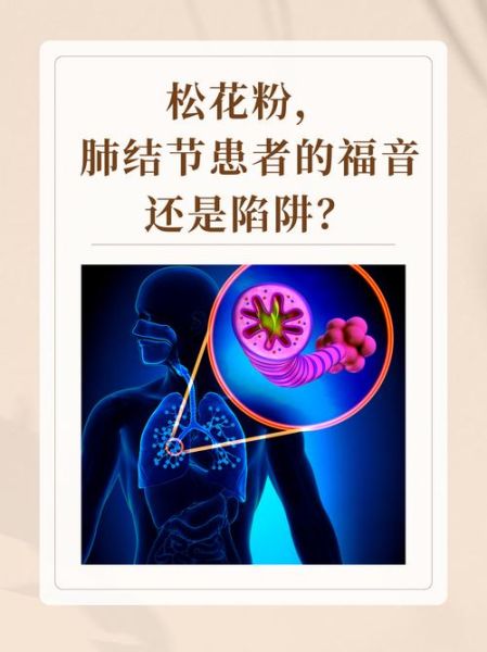 长期吃花粉会导致乳腺结节吗_乳腺结节与花粉的关系-第3张图片-山城妙识