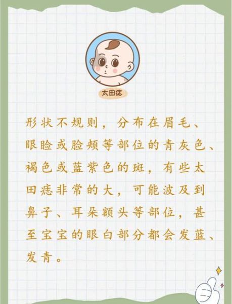 牛奶咖啡斑胎记能彻底去除吗_费用大概多少钱-第2张图片-山城妙识
