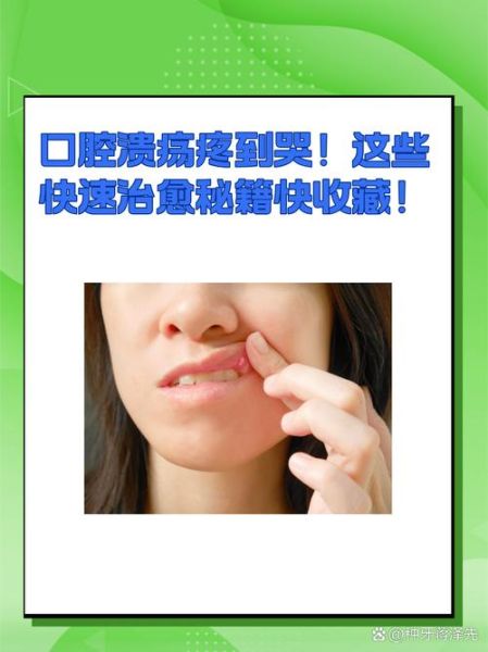 口腔溃疡一夜见效偏方_口腔溃疡怎么快速止痛-第1张图片-山城妙识