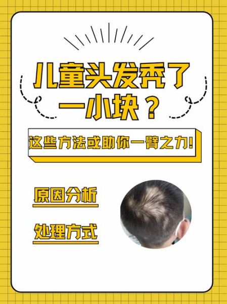 头顶秃了一小块怎么办_秃一小块会扩散吗-第1张图片-山城妙识 头顶秃了一小块怎么办_秃一小块会扩散吗-第1张图片-山城妙识