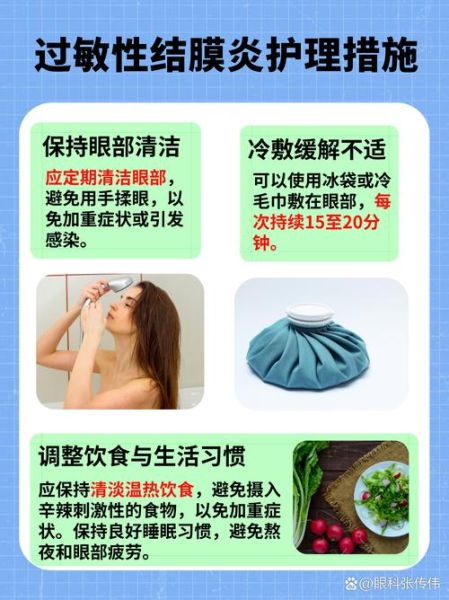 过敏性结膜炎多久能好_过敏性结膜炎几天能痊愈-第1张图片-山城妙识 过敏性结膜炎多久能好_过敏性结膜炎几天能痊愈-第1张图片-山城妙识