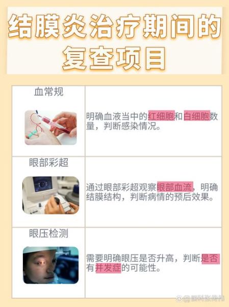 过敏性结膜炎多久能好_过敏性结膜炎几天能痊愈-第3张图片-山城妙识 过敏性结膜炎多久能好_过敏性结膜炎几天能痊愈-第3张图片-山城妙识