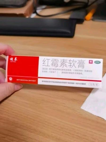 红霉素软膏的作用和功效_红霉素软膏可以涂痘痘吗-第3张图片-山城妙识 红霉素软膏的作用和功效_红霉素软膏可以涂痘痘吗-第3张图片-山城妙识
