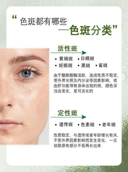 黑色素克星是什么_如何有效淡化色斑-第1张图片-山城妙识 黑色素克星是什么_如何有效淡化色斑-第1张图片-山城妙识