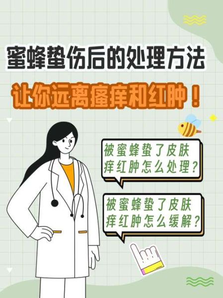 马蜂蛰了怎么快速消肿_马蜂蛰了止痒最有效的方法-第1张图片-山城妙识 马蜂蛰了怎么快速消肿_马蜂蛰了止痒最有效的方法-第1张图片-山城妙识