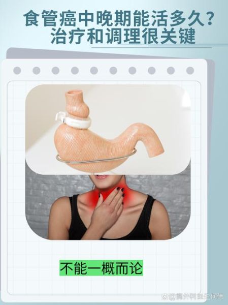 食道癌晚期能活多久_食道癌晚期还能治吗-第1张图片-山城妙识 食道癌晚期能活多久_食道癌晚期还能治吗-第1张图片-山城妙识