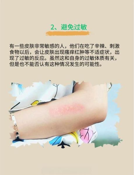 辣椒素会烧伤皮肤吗_辣椒素对皮肤伤害程度-第1张图片-山城妙识 辣椒素会烧伤皮肤吗_辣椒素对皮肤伤害程度-第1张图片-山城妙识