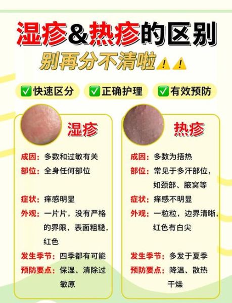 过敏和湿疹的区别_如何判断是过敏还是湿疹-第2张图片-山城妙识