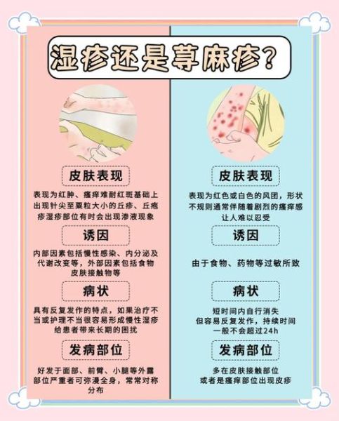 过敏性荨麻疹图片_如何辨别风团与湿疹-第3张图片-山城妙识