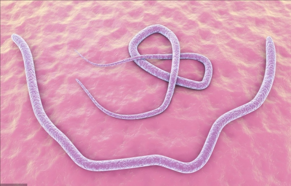 猪肉绦虫是什么动物_猪肉绦虫对人体有哪些危害-第2张图片-山城妙识 猪肉绦虫是什么动物_猪肉绦虫对人体有哪些危害-第2张图片-山城妙识