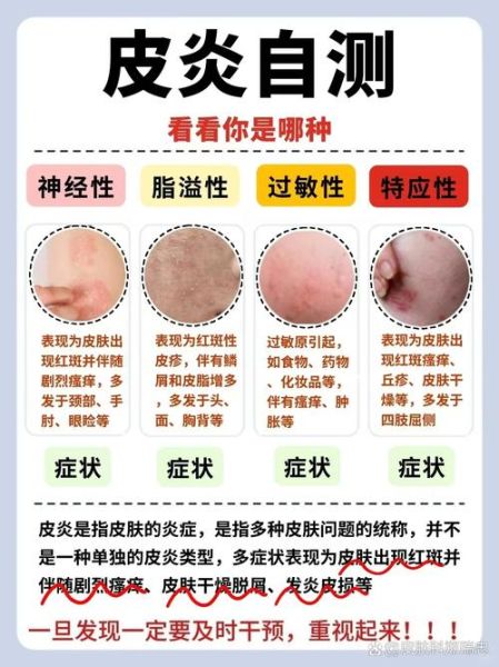 皮肤病图片对照大全_如何快速识别常见皮肤病-第1张图片-山城妙识 皮肤病图片对照大全_如何快速识别常见皮肤病-第1张图片-山城妙识