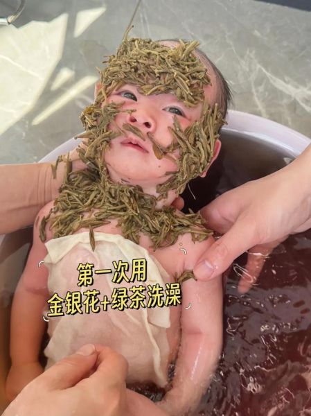 蚕豆病可以吃金银花吗_蚕豆病金银花禁忌-第1张图片-山城妙识