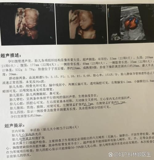 大排畸是四维彩超吗_两者区别在哪-第3张图片-山城妙识 大排畸是四维彩超吗_两者区别在哪-第3张图片-山城妙识