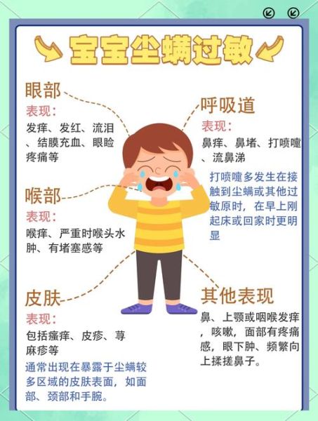 过敏症状有哪些表现_过敏症状怎么缓解-第1张图片-山城妙识