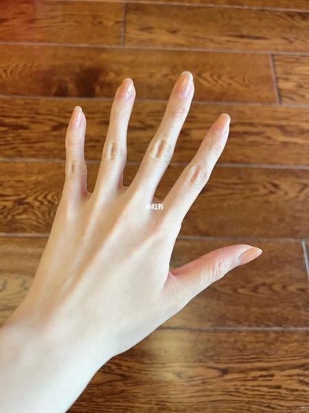 鸡爪手图片_鸡爪手怎么矫正-第1张图片-山城妙识 鸡爪手图片_鸡爪手怎么矫正-第1张图片-山城妙识