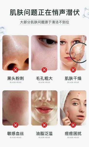 脸上皮肤毒素垃圾怎么排出来_脸上毒素垃圾排出方法-第2张图片-山城妙识 脸上皮肤毒素垃圾怎么排出来_脸上毒素垃圾排出方法-第2张图片-山城妙识