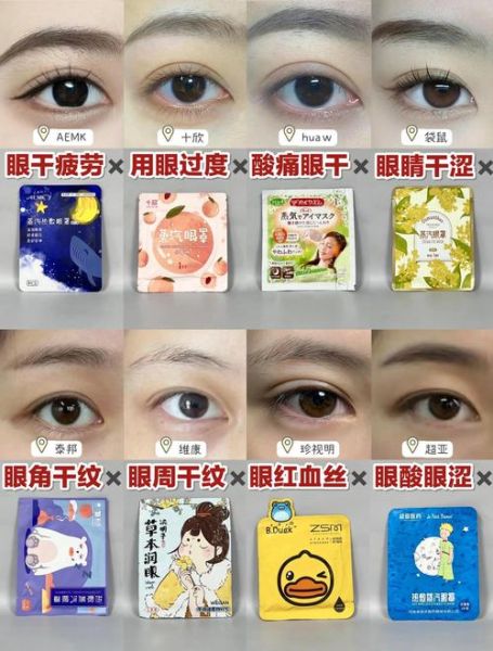 蒸汽眼罩对眼睛有害吗_蒸汽眼罩副作用有哪些-第2张图片-山城妙识