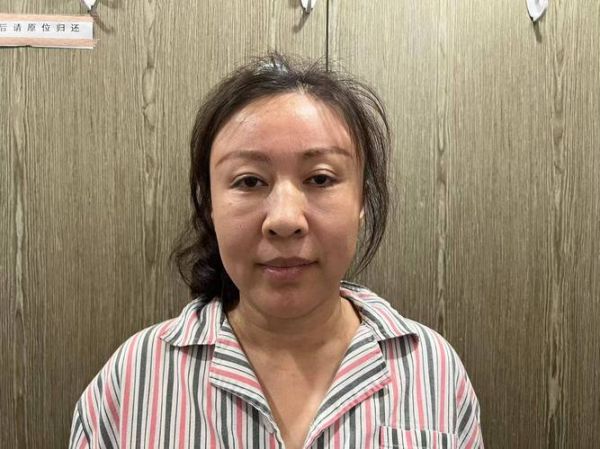 美容拉皮是怎么做的_拉皮手术全过程-第3张图片-山城妙识 美容拉皮是怎么做的_拉皮手术全过程-第3张图片-山城妙识