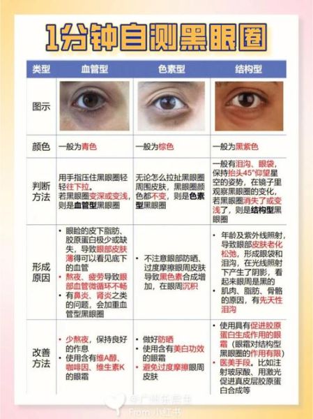 如何快速去黑眼圈_10分钟见效的方法-第3张图片-山城妙识 如何快速去黑眼圈_10分钟见效的方法-第3张图片-山城妙识