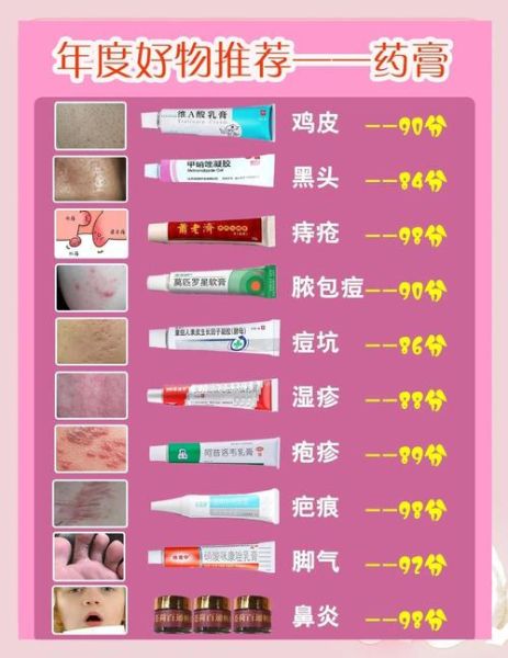 祛痘最好的药膏有哪些_怎么选-第2张图片-山城妙识