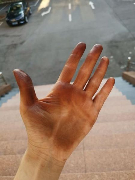 青皮核桃汁弄到手上怎么洗_手上青皮核桃汁洗不掉怎么办-第3张图片-山城妙识