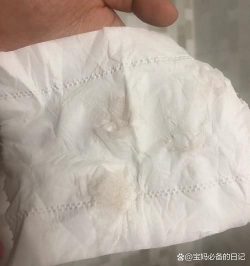 褐色血是生化妊娠吗_褐色血是否代表胚胎已生化-第2张图片-山城妙识 褐色血是生化妊娠吗_褐色血是否代表胚胎已生化-第2张图片-山城妙识