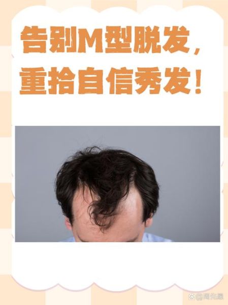 脱发严重是什么原因引起的_如何快速止脱-第2张图片-山城妙识 脱发严重是什么原因引起的_如何快速止脱-第2张图片-山城妙识