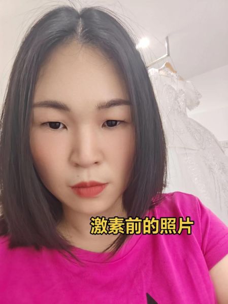 醋酸泼尼松片治什么病_醋酸泼尼松片副作用多久消失-第2张图片-山城妙识