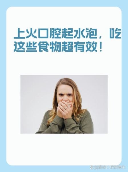 口腔上火了吃什么降火最快_口腔上火吃什么食物好-第3张图片-山城妙识