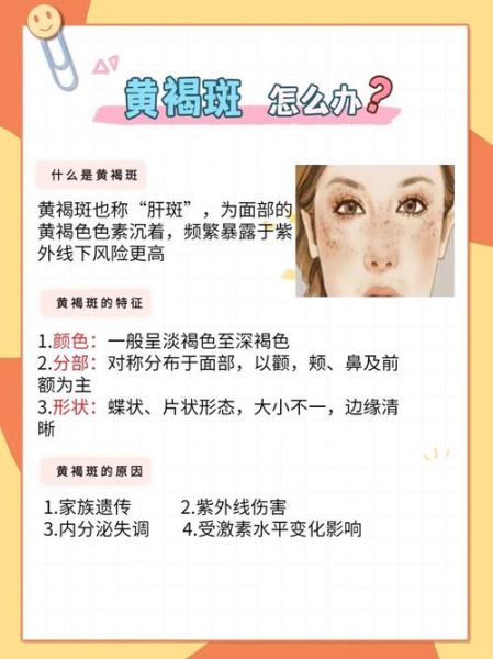 雀斑能去掉吗_雀斑怎么彻底去除-第1张图片-山城妙识 雀斑能去掉吗_雀斑怎么彻底去除-第1张图片-山城妙识