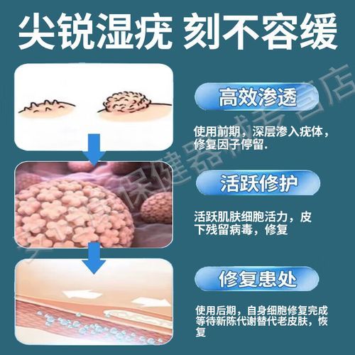 菜花状疣体是不是已经很严重了_菜花状疣体怎么治疗-第3张图片-山城妙识