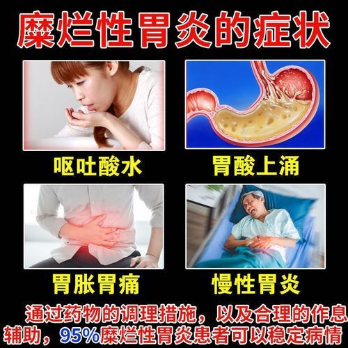 糜烂性胃炎吃什么药最好_糜烂性胃炎吃什么药最好最快-第3张图片-山城妙识 糜烂性胃炎吃什么药最好_糜烂性胃炎吃什么药最好最快-第3张图片-山城妙识