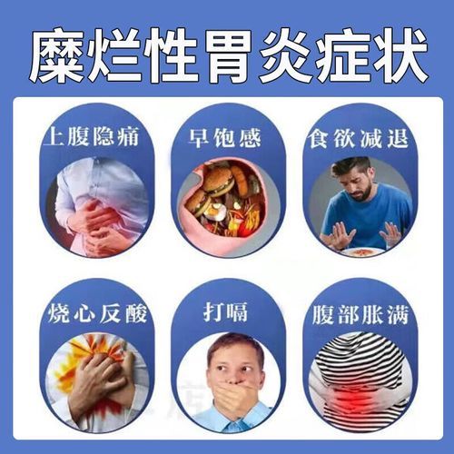 糜烂性胃炎吃什么药最好_糜烂性胃炎吃什么药最好最快-第1张图片-山城妙识 糜烂性胃炎吃什么药最好_糜烂性胃炎吃什么药最好最快-第1张图片-山城妙识