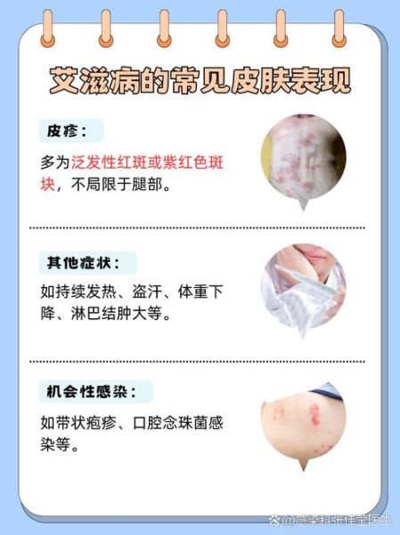 艾蒿过敏症状有哪些_艾蒿过敏怎么办-第1张图片-山城妙识