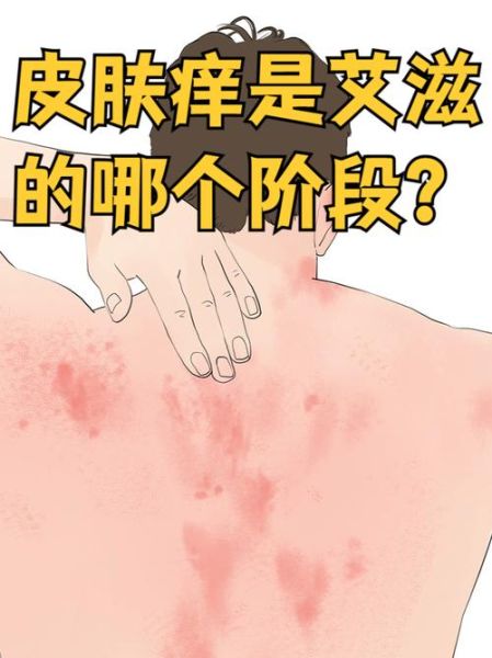 艾蒿过敏症状有哪些_艾蒿过敏怎么办-第2张图片-山城妙识