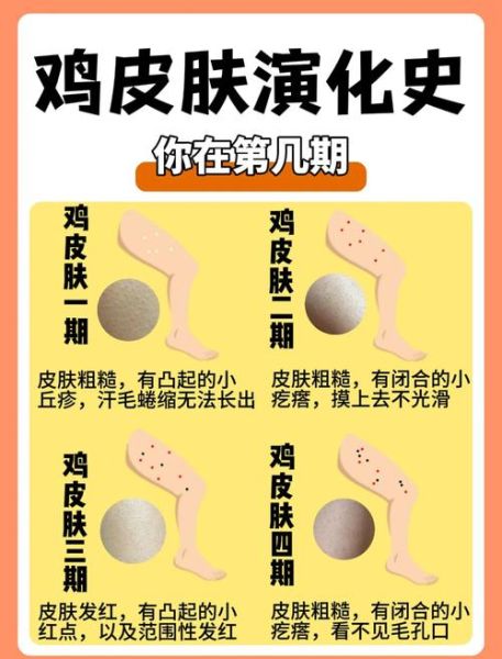 鸡皮肤会自己消失吗_鸡皮肤多久能好-第3张图片-山城妙识