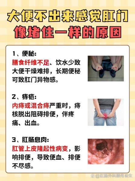 大便拉不出来怎么办_快速解决方法-第3张图片-山城妙识
