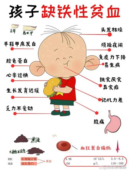 贫血是怎么造成的_贫血的原因有哪些-第2张图片-山城妙识