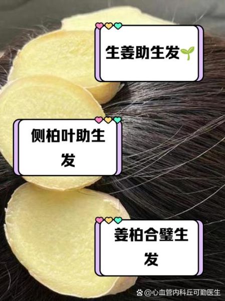 生姜擦头皮能生发吗_生姜生发是真的吗-第3张图片-山城妙识 生姜擦头皮能生发吗_生姜生发是真的吗-第3张图片-山城妙识