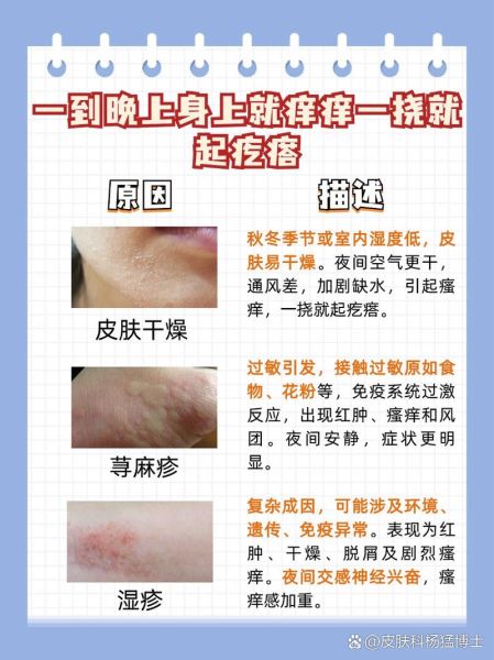 皮肤痒一抓就起疙瘩怎么回事_皮肤痒一抓就起疙瘩怎么办-第1张图片-山城妙识