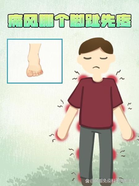 脚疼是不是痛风_痛风脚疼怎么判断-第2张图片-山城妙识 脚疼是不是痛风_痛风脚疼怎么判断-第2张图片-山城妙识