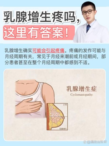乳腺增生有哪些症状_乳腺增生会疼吗-第2张图片-山城妙识