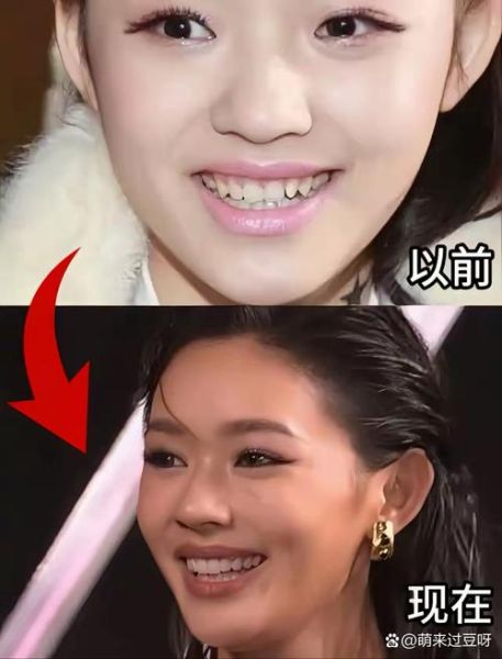 鲶鱼脸是什么长相_鲶鱼脸五官特征-第2张图片-山城妙识 鲶鱼脸是什么长相_鲶鱼脸五官特征-第2张图片-山城妙识