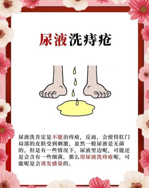 痔疮永不复发祖传秘方_痔疮根治偏方真的有效吗-第2张图片-山城妙识