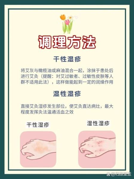 血热的症状有哪些_湿疹反复发作怎么办-第2张图片-山城妙识