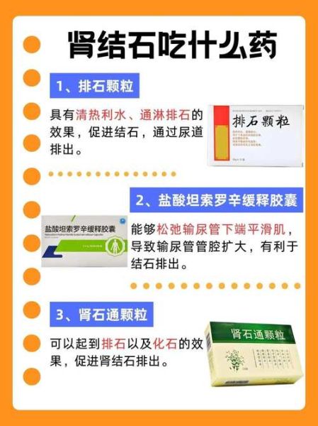 肾结石怎样治最好_肾结石吃什么药排石最快-第1张图片-山城妙识