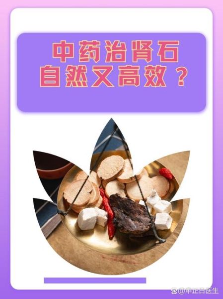 肾结石怎样治最好_肾结石吃什么药排石最快-第3张图片-山城妙识