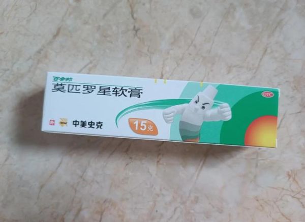 湿疹吃什么药最好_湿疹用什么药膏最有效-第1张图片-山城妙识 湿疹吃什么药最好_湿疹用什么药膏最有效-第1张图片-山城妙识