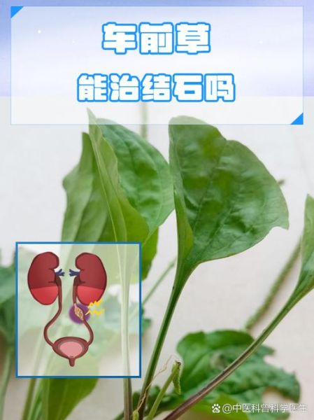 车前草能治前列腺炎吗_车前草治疗前列腺炎效果怎么样-第3张图片-山城妙识